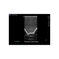 Blue Phantom Epidural Ultrasound Training Model | American Hospital Supply